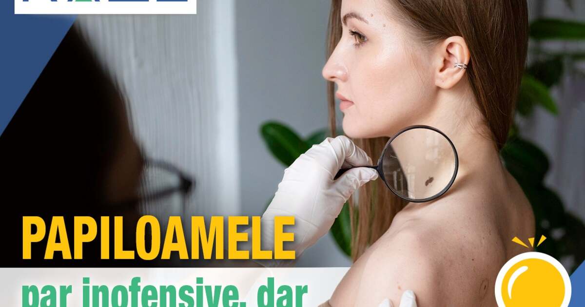 Papiloamele cutanate: mici leziuni ale pielii care pot crea disconfort ...